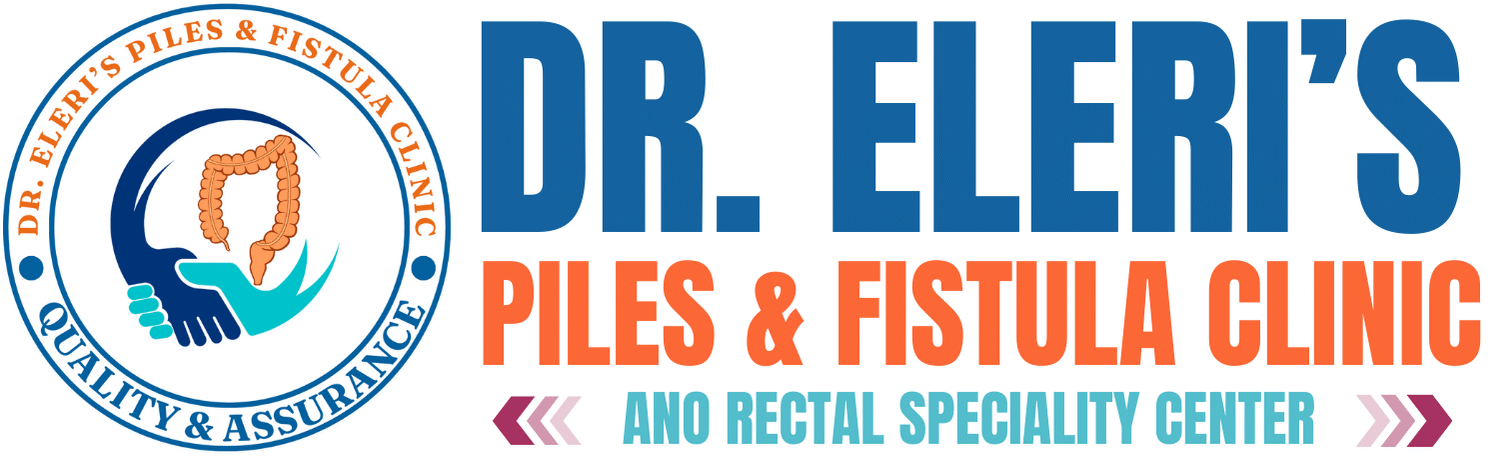 Pilonidal Sinus Treatment at Dr Eleri’s Piles & Fistula Clinic – Dr ...